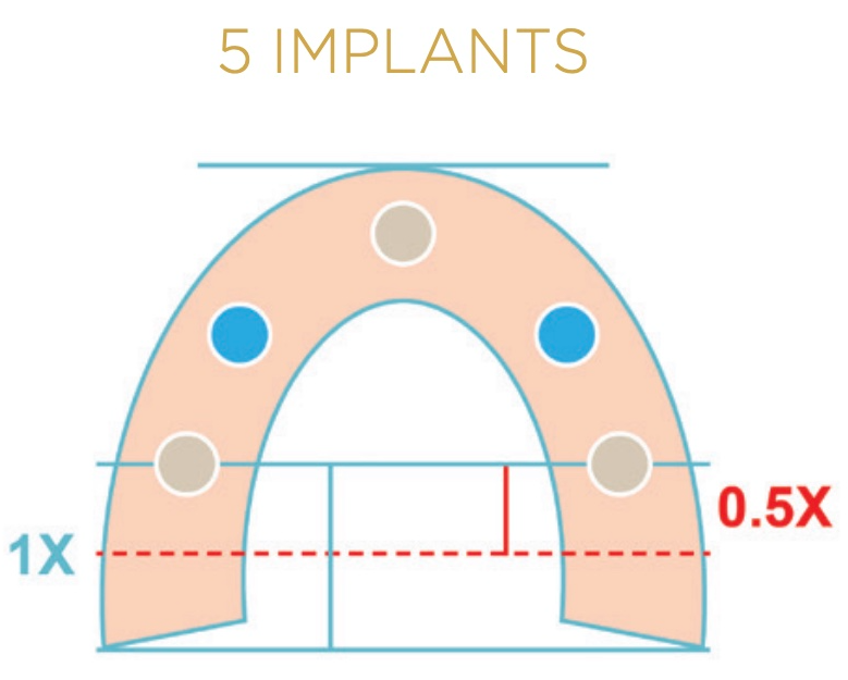 How Does LOCATOR FIXED Work-V2