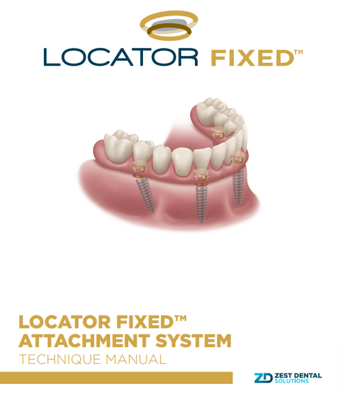 How Does LOCATOR FIXED Work-V2
