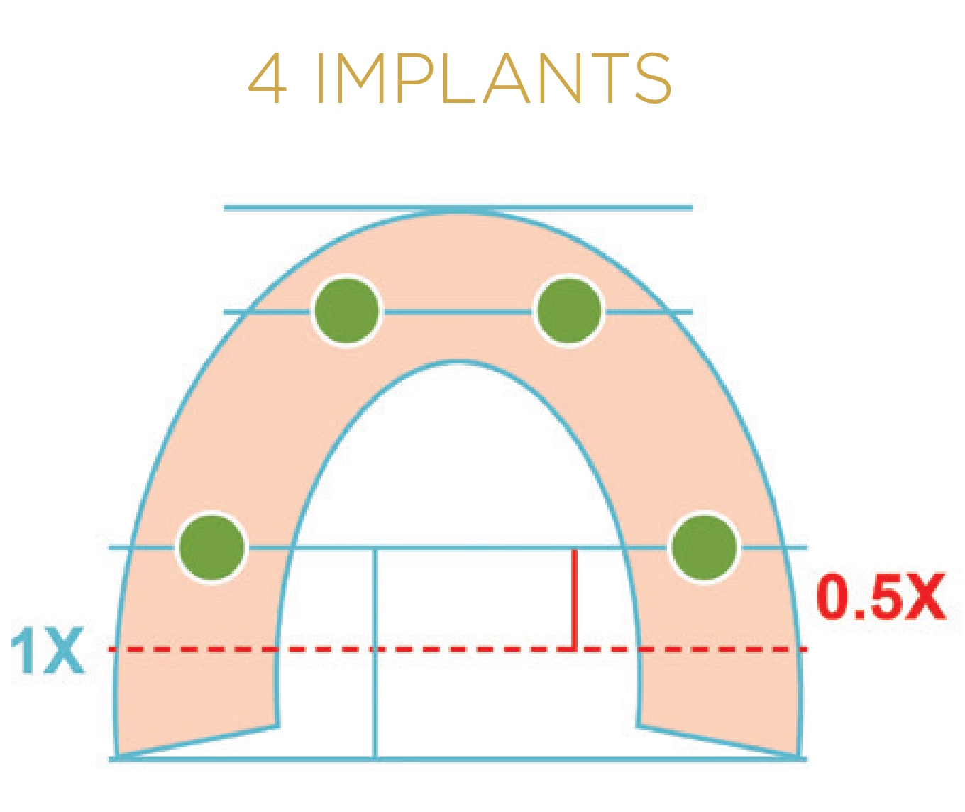 How Does LOCATOR FIXED Work-V2
